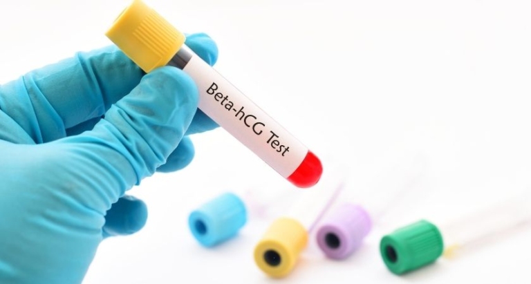 Beta HCG Testi Nedir? - Op. Dr. Şükran Çakmak | Tüp Bebek Tedavisi ve ...
